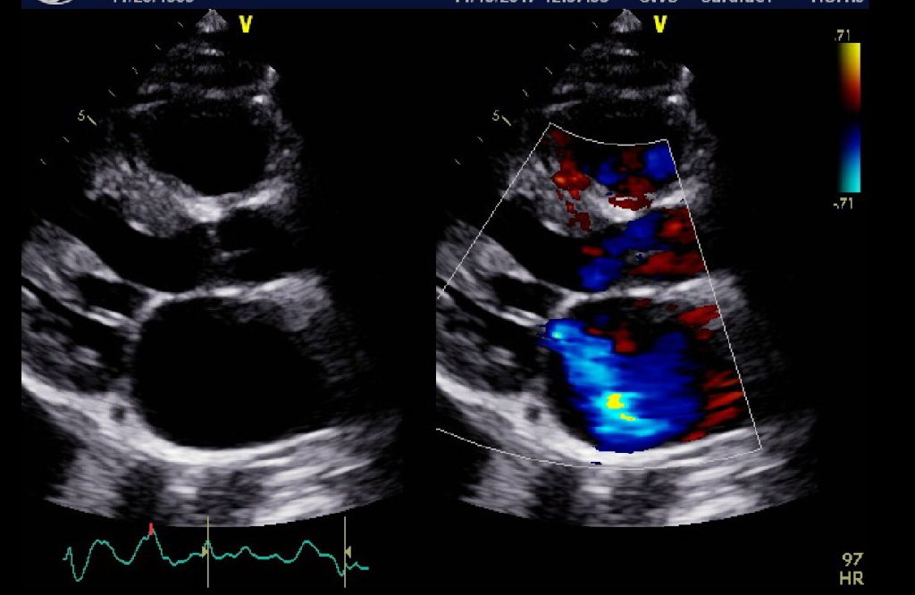 Echocardiography | Imaging Science Education Programs