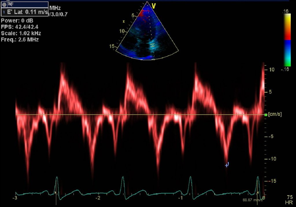Echocardiography | Imaging Science Education Programs