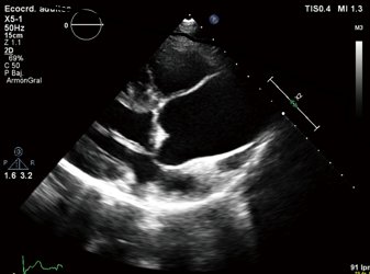 Echocardiography | Imaging Science Education Programs