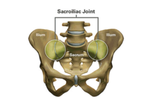 SI Joint Fusion - Thomas Hospitals