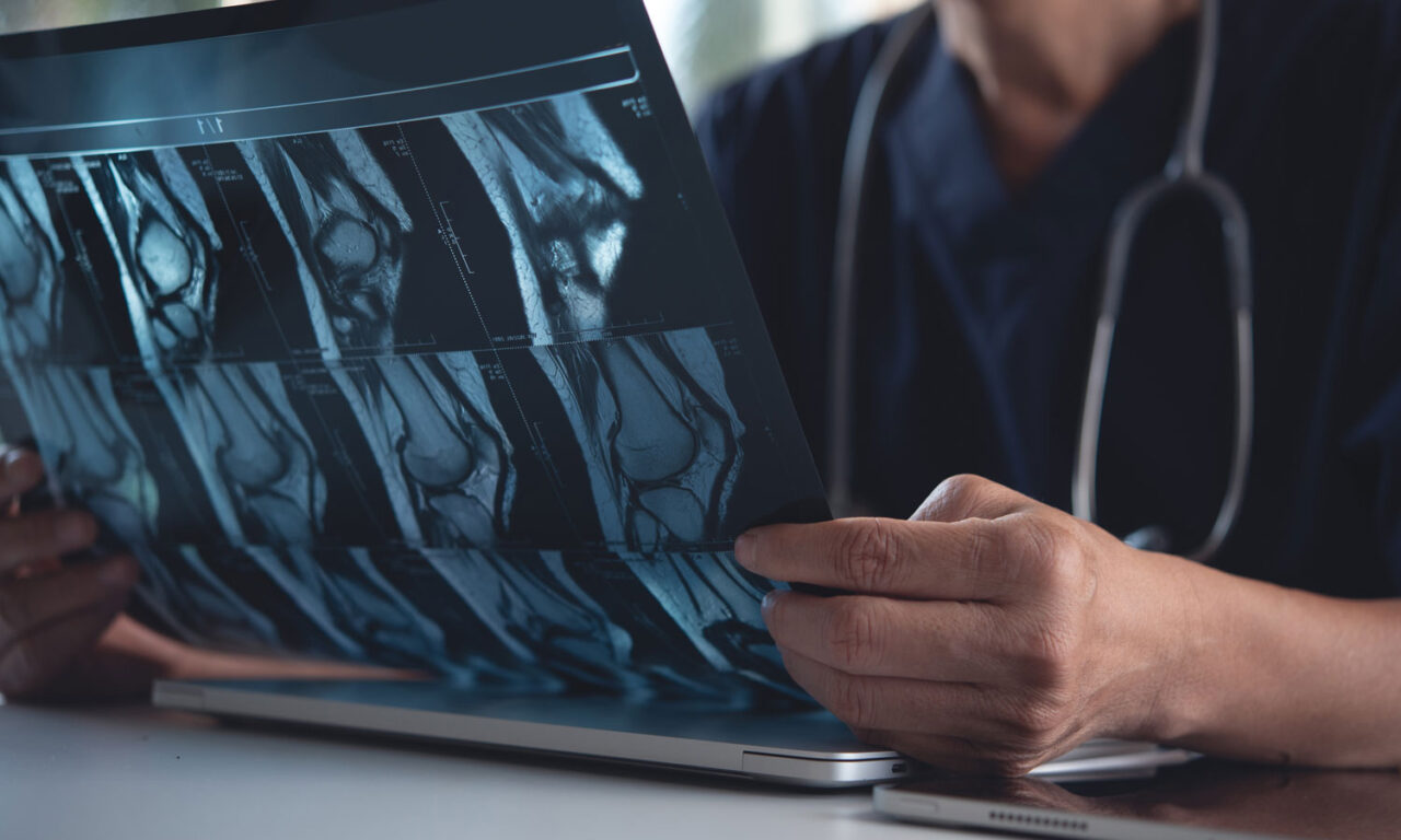 Bone and Soft Tissue Sarcoma | WVU Cancer Institute