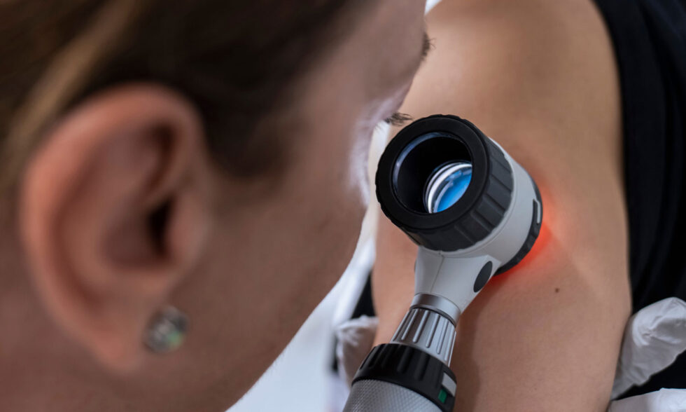 Melanoma and Other Skin Cancers | WVU Cancer Institute