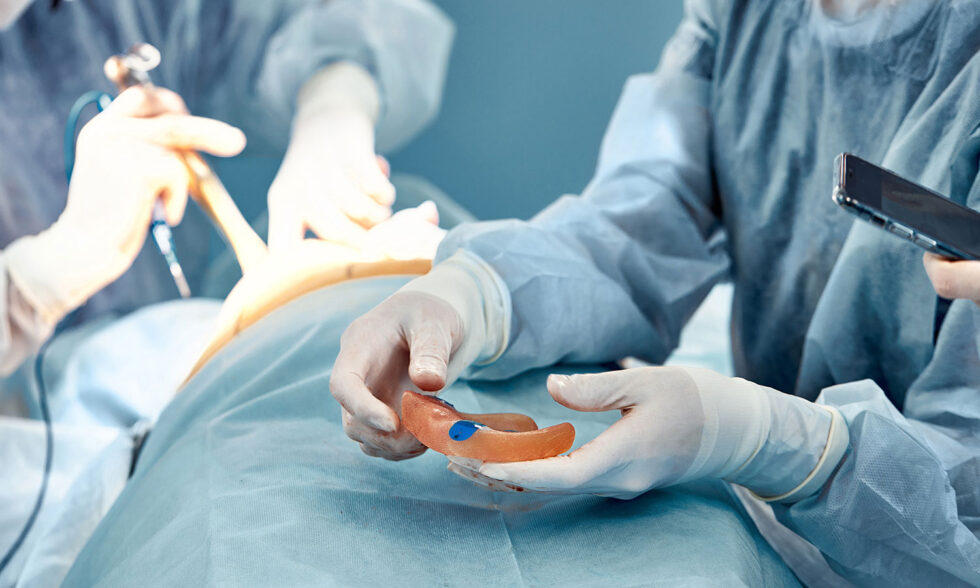 Reconstructive Surgery | WVU Cancer Institute